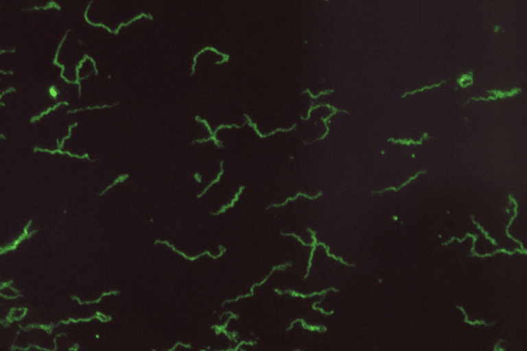 Lyme Spirochetes in the Myelin Sheath of Brain Nerve Cells - LDF