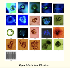 Study Finds Tapeworms in the Spinal Fluid of MS Patients - Live Disease ...