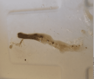 Intestinal Flukes - Live Disease Free