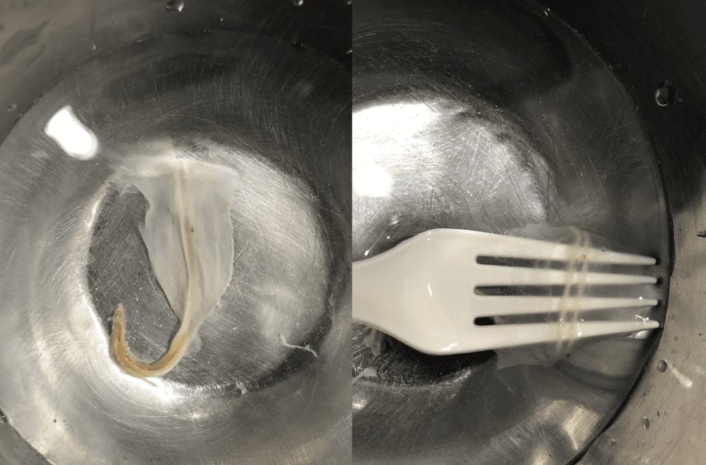 Intestinal Flukes - Live Disease Free