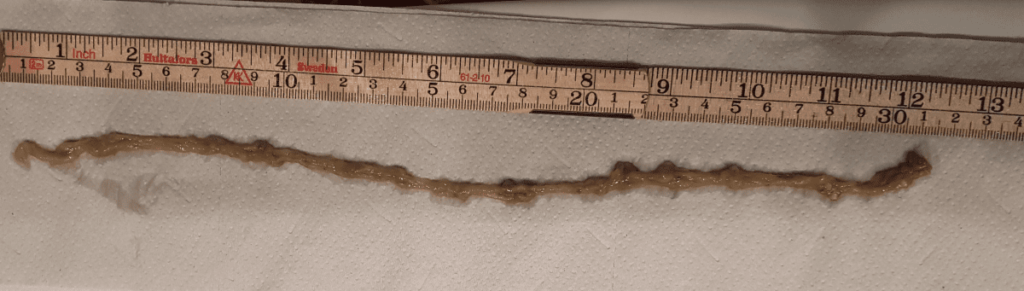 Large Roundworms in MS - Live Disease Free