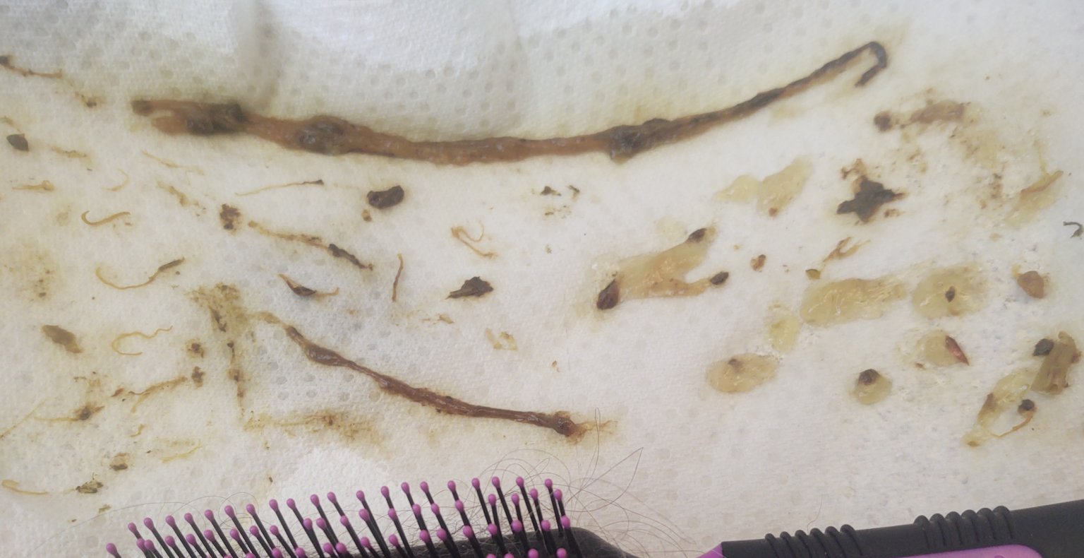 Treating Parasites Case Study #4 – Recovering from MS April 2023 - Live ...